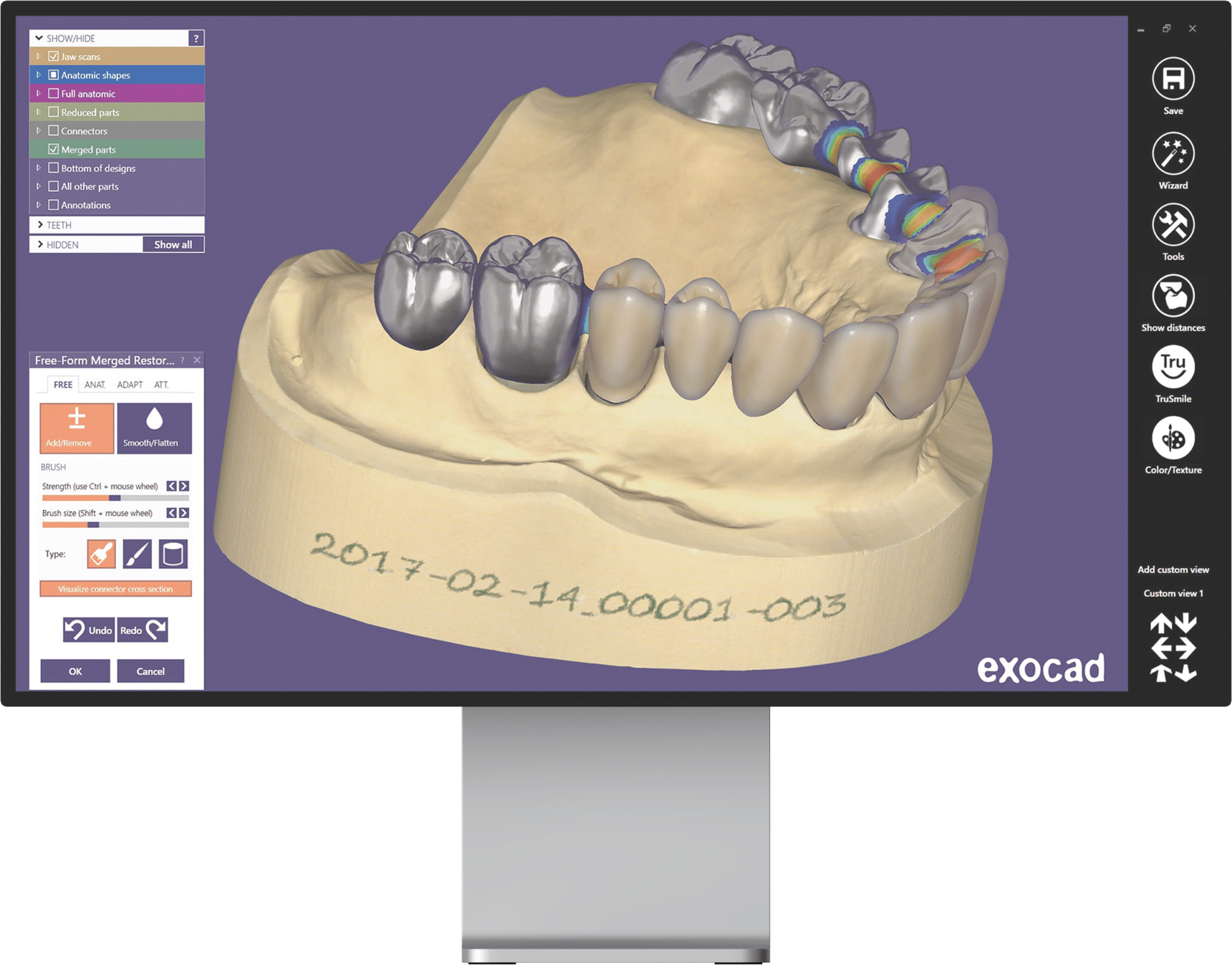Exocad - Licence StandAlone